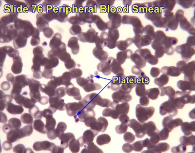 Platelets Slide
